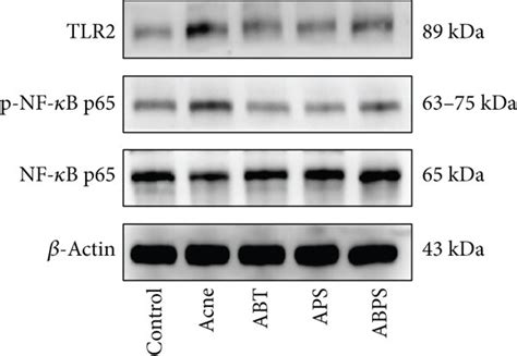 Abt Aps And Abps Decreased The Expression Of Tnf α Il 1β And