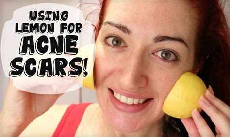 How To Get Rid Of Acne Scars