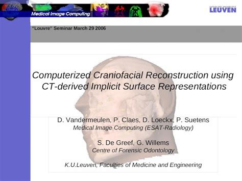 Ppt Computerized Craniofacial Reconstruction Using Ct Derived
