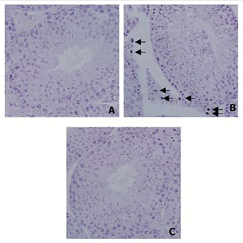 Micrographs Of Testis Tissue In Different Groups Of Mice 5 Mm Thick