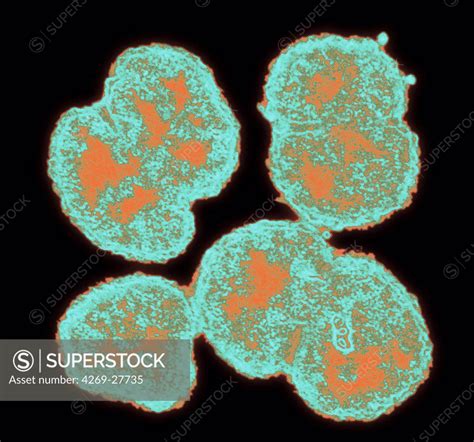 Neisseria Gonorrhoeae Color Enhanced Electron Micrograph Of Neisseria