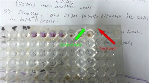Treponema Pallidum Hemagglutination Tpha Test 48 Off