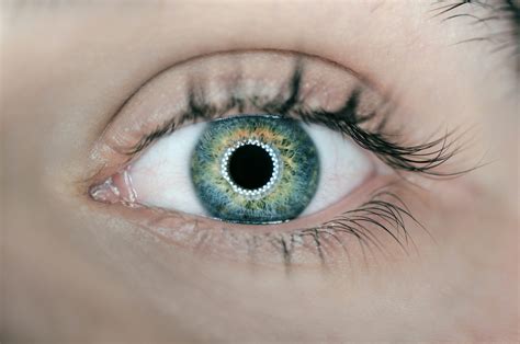 What You Need To Know About Astigmatism Symptoms Causes And Treatments