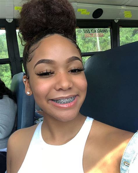 𝐩𝐢𝐧 𝐦𝐢𝐥𝐚𝐠𝐮𝐬𝐭𝐚𝐯𝐨 💲 Cute Braces Braces Colors Cute Braces Colors