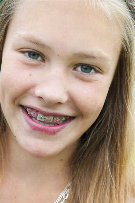Pictures Of Girls With Braces Telegraph