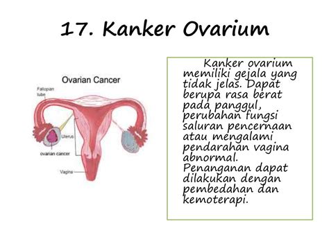 Kelainan Dan Penyakit Pada Sistem Reproduksi