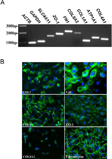 Characterization Of Immortalized Hcecs A Mrna Expression Of Slc4a11