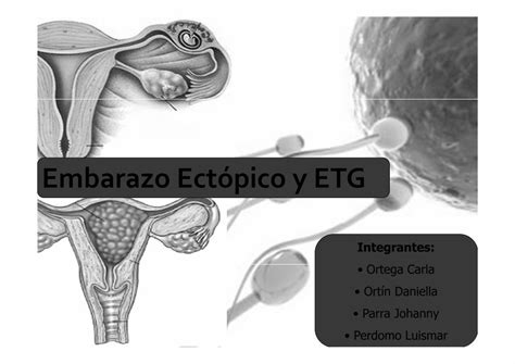 Pdf Embarazo Ectópico Y Etg Dokumen Tips