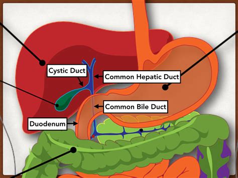 Gallbladder Cholelithiasis Vs Cholecystitis Vs Cholangitis Vs