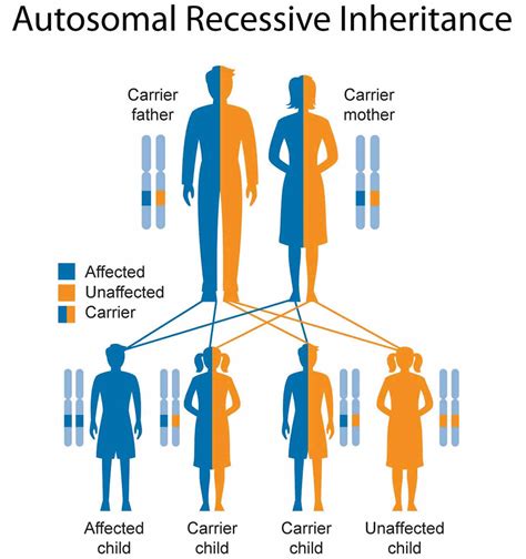 Waardenburg Syndrome Causes Types Symptoms Diagnosis And Treatment