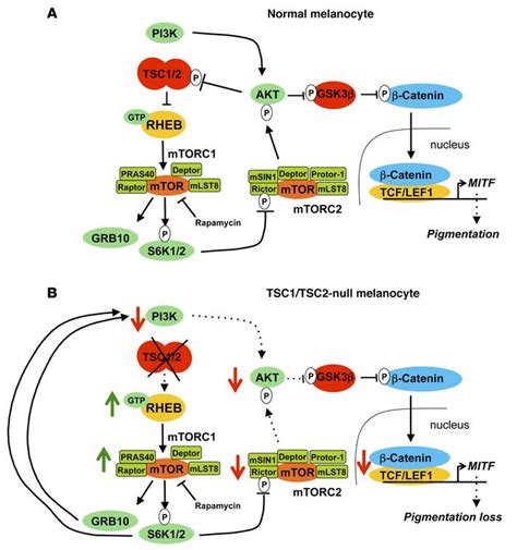 Jci Tuberous Sclerosis Complex Inactivation Disrupts Melanogenesis