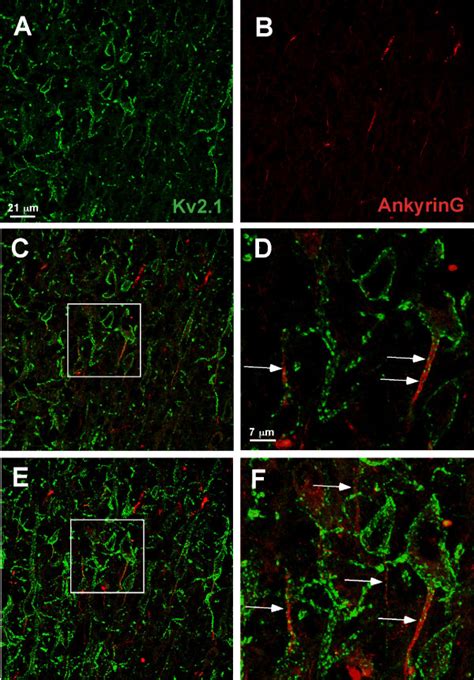 Localization Of Kv2 1 Clusters To The Ais Of Layer Iv Cortical Neurons