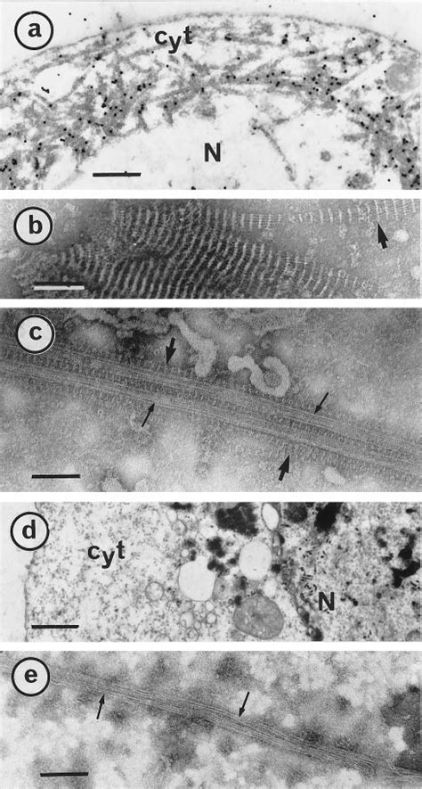 P18 Paracrystals Decorate Mts Within Sf9 Cells Cells Infected For 3