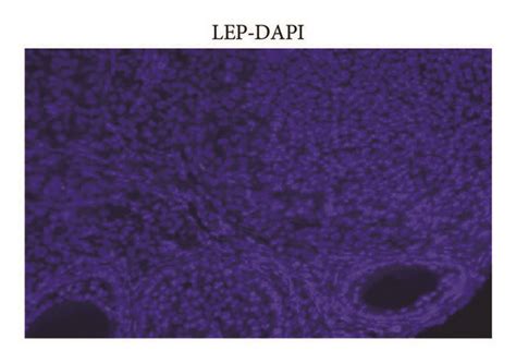 Lep Protein Expression In Ovarian Tissue Sections In Different Treated