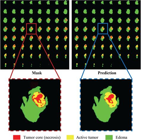 frontiers a deep multi task learning framework for brain