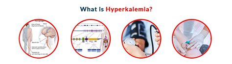 Hyperkalemia Causes Symptoms Diagnosis Management And Treatment