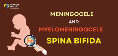 Inside Out Understanding Spina Bifida Happiest Health