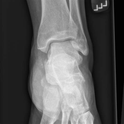 msk radiograph case 7
