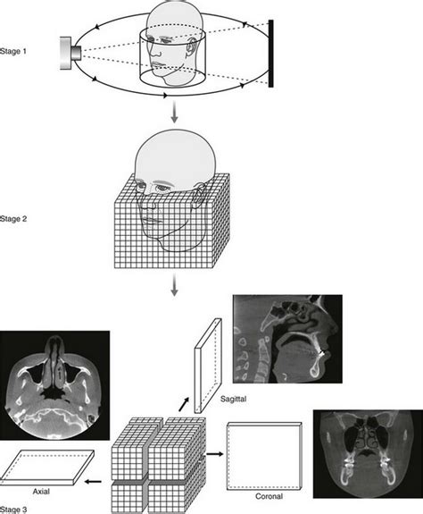 13 Cone Beam Computed Tomography Cbct Pocket Dentistry