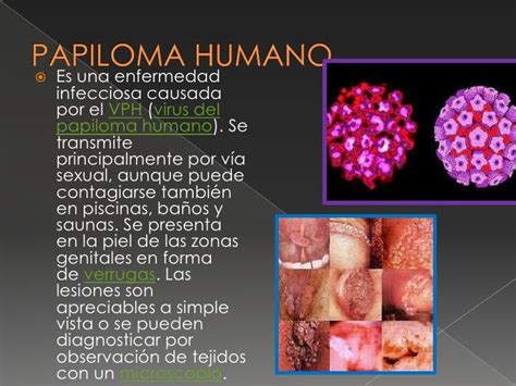 Prevención De Vih Sida E Infecciones De Transmisión Sexual