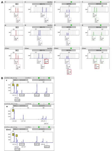 Str Analysis The Sex Chromosome Specific Marker Amelogenin Amel The