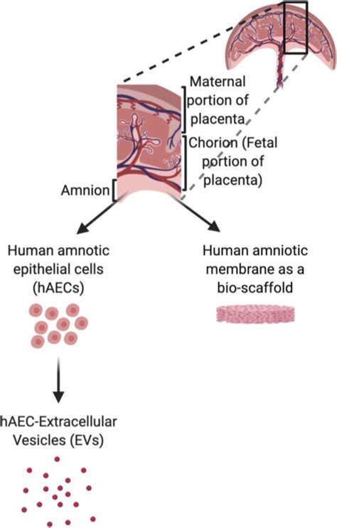 The Amniotic Membrane Is A Source Of Cells Extracellular Vesicles And