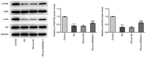 Platycodin D Inhibits The Proliferation Invasion And Migration Of