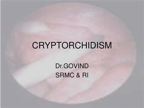 Ppt Cryptorchidism Powerpoint Presentation Id 474422