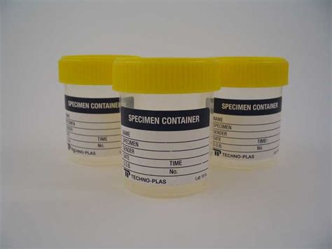 urine containers see table below trajan scientific and medical