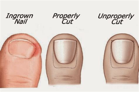 Helpful Foot Tips August 2021 Ses Podiatry