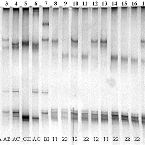 Polymerase Chain Reaction Single Strand Conformation Polymorphism