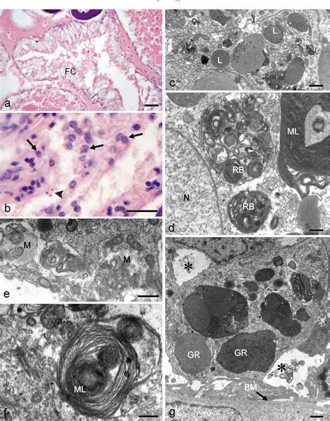 Figure 1 From Ovarian Follicular Atresia Is Mediated By Heterophagy