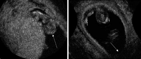 Figure 2 From A Semi Automatic Technique For Fetus Segmentation In 3d