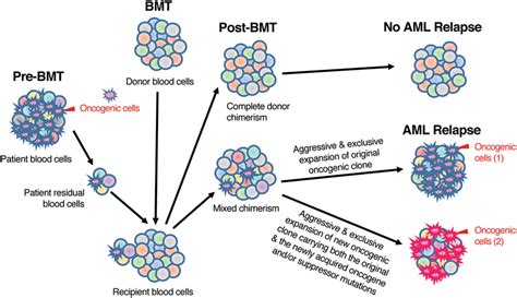 Model Of Aml Relapse In Bone Marrow Transplanted Aml Patients In Bone