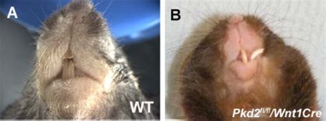 Adult Heads Of Wild Type And Pkd2 Conditional Knockout Mice Showing
