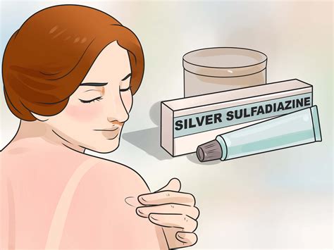 How To Get Rid Of A Sunburn 10 Steps With Pictures Wikihow