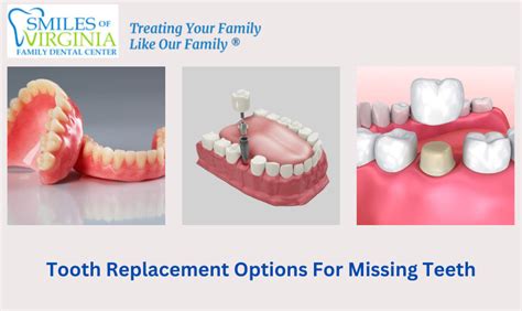 Why In Office Teeth Bleaching Deserves The Expense Tompkins Oral