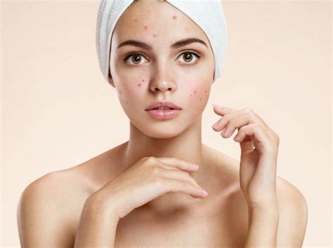 Quels Produits Et Soins Conviennent à Une Peau Acnéique