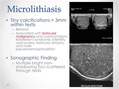 Ppt Scrotal Ultrasound Powerpoint Presentation Id 5671926