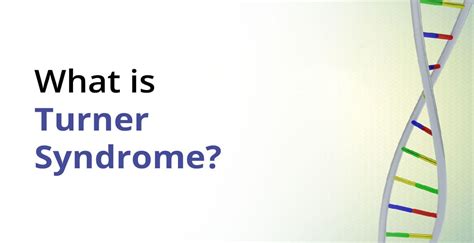 What Is Turner Syndrome Symptoms And Causes Birla Fertility And Ivf