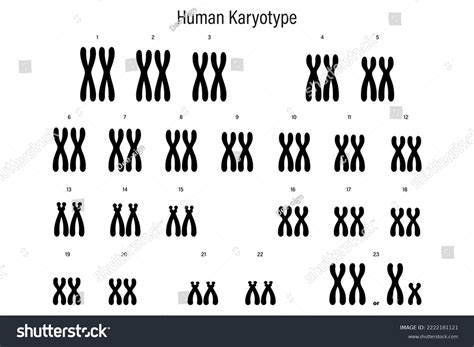 Human Karyotype Autosome Sex Chromosome Male Stock Vector Royalty Free