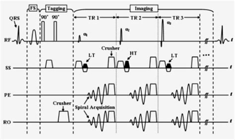 Senc Pulse Sequence Diagram Fs Fat Suppression Rf Radiofrequency