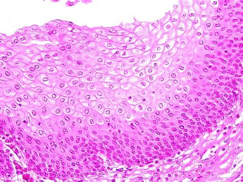 Histological Sample Squamous Epithelial Cells Under Microscope Stock