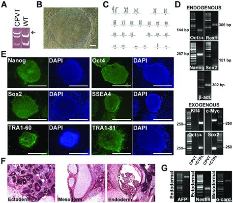 Characterization Of Cpvt Ipscs A Mutation Analysis Confirming The