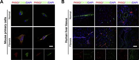 Pyruvate Kinase M2 Tetramerization Protects Against Hepatic Stellate