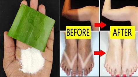 100 Effective Full Body Whitening Treatment Naturally At Home