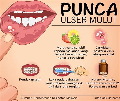 Cara Merawat Ulser Mulut