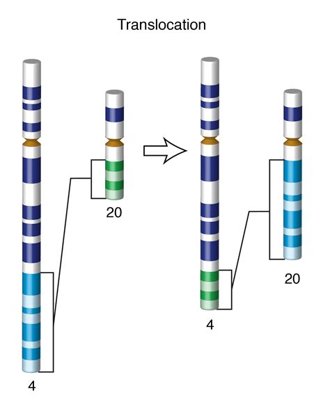 translocation