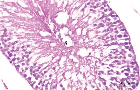 Photomicrographs Of Sections In Testis Of Control Rat Groups A