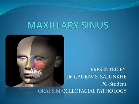 Maxillary Sinus Fistula